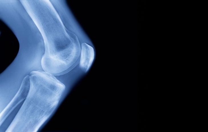 No, Running Doesn't Wear Down Your Cartilage. It Strengthens Your ...